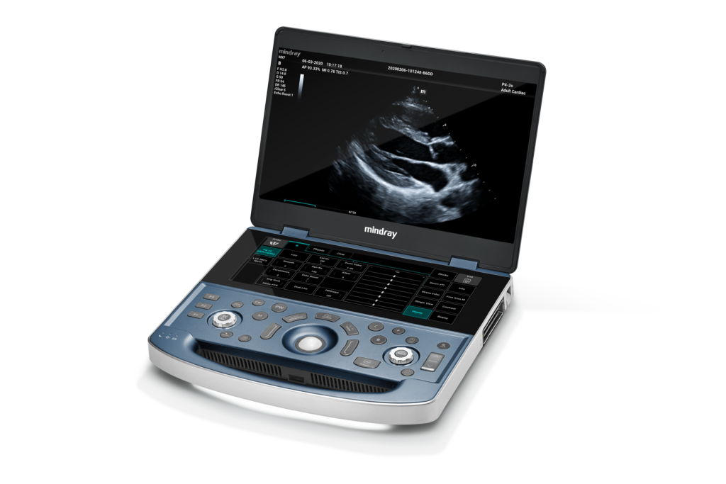 Sistema de Ultrassom MX7 - Mindray | Sinal Vital